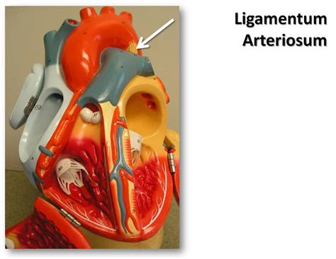 Ligamentum Arteriosum Anterior View The Anatomy Of The … Flickr