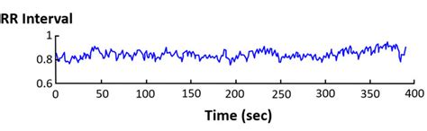 Example Of A Signal Obtained From Ecg R R Intervals Download