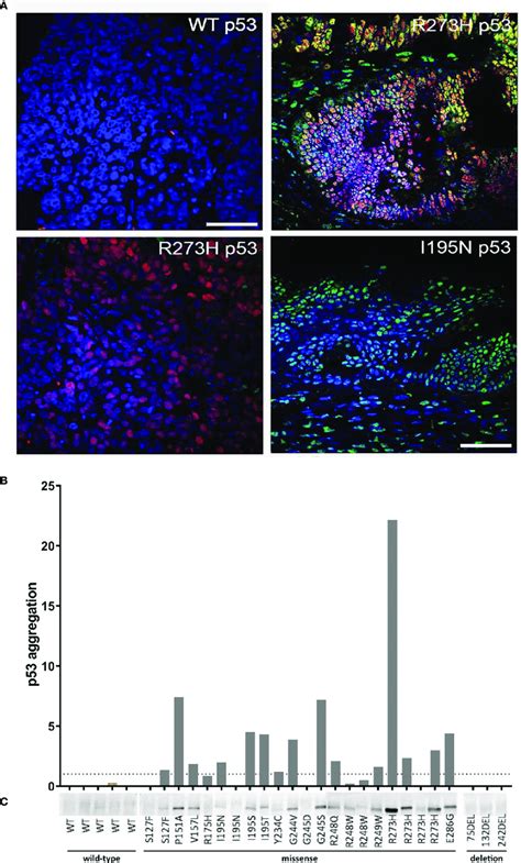 Detection Of P53 Aggregates In Ovarian Cancer Oc Tissue Specimens Download Scientific