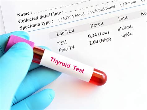 Tsh Test In Qrex Diagnostic Centre