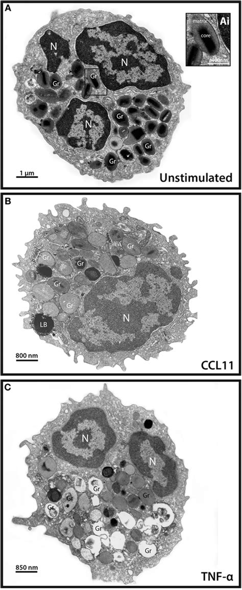 Eosinophils Microscope