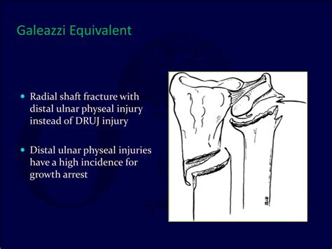 Ppt Pediatric Forearm Fractures Diagnosis And Treatment Guide