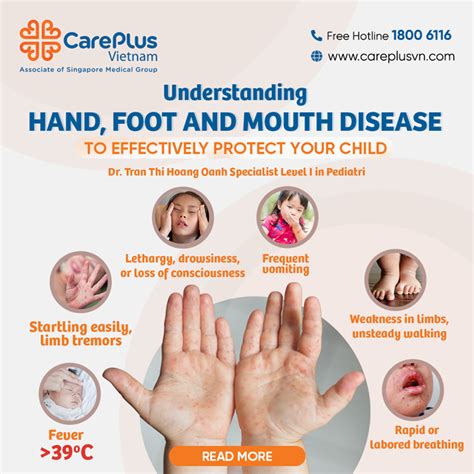 Everything You Need To Know About Hand Foot And Mouth Disease