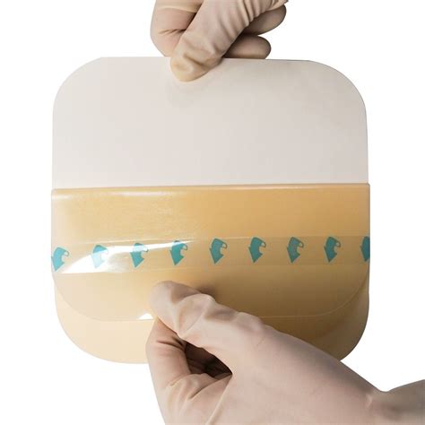 Hydrocolloid Dressing For Burn Wounds At Roseanne Foster Blog