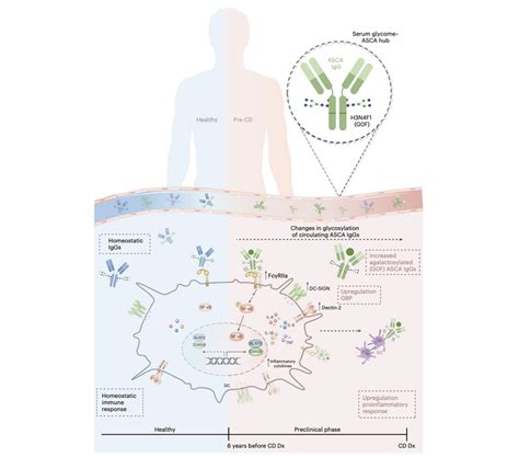 A Unique Serum Anti Yeast Saccharomyces Cerevisiae Igg Predicts