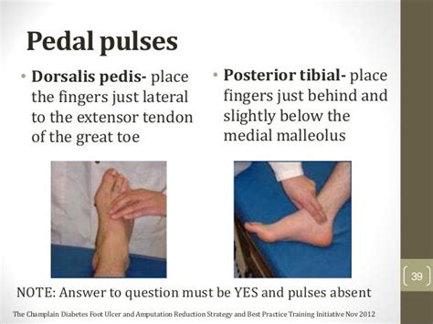 Dorsalis Pedis Pulse Pronunciation