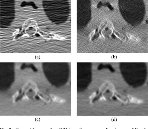 Figure 2 From Penalized Weighted Least Squares Approach To Sinogram