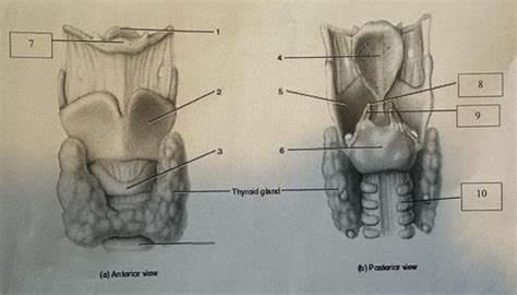 CSD Exam Diagrams Flashcards Quizlet