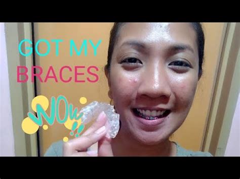 Got My Braces Youtube