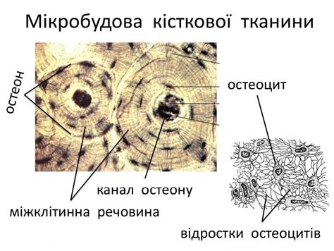 Замалюйте микробудо ву гіалінового хряща і підпишіть структурні компоненти хондро цити