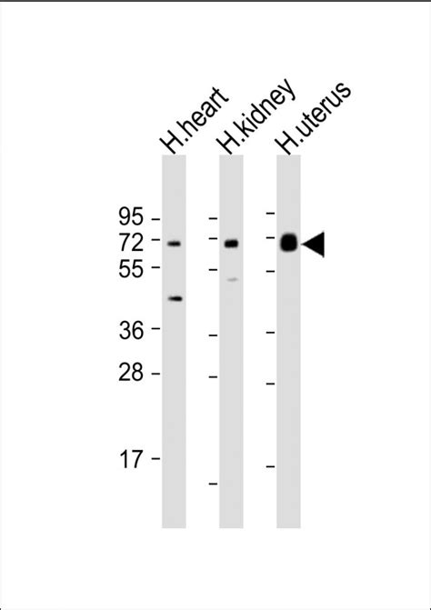 SPTLC Antibody Cat No ProSci