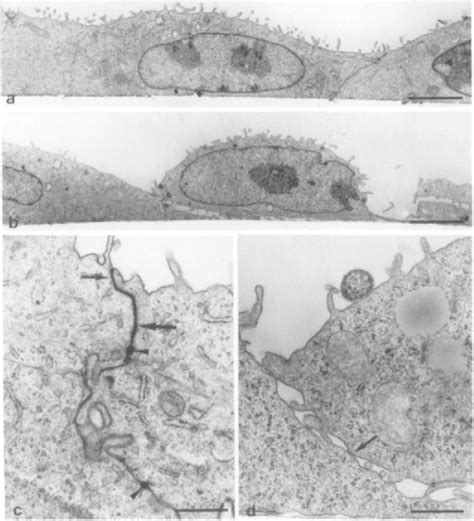 Figure 3 From Loss Of Epithelial Differentiation And Gain Of