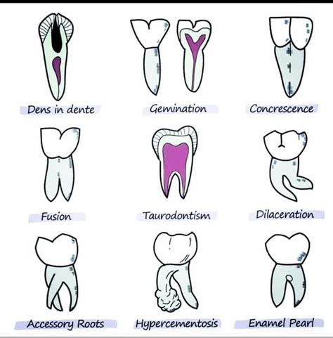 Different Types Of Teeth And Their Functions