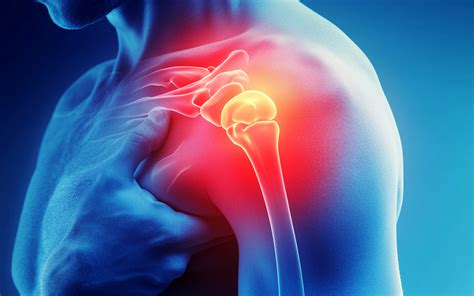 Rotator Cuff Tendonitis Md Searchlight