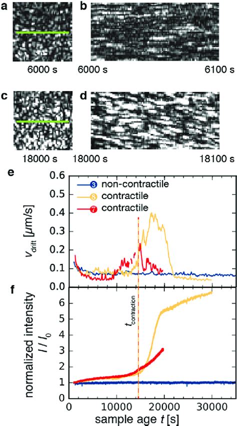 Microscopic Dynamics Of Contractile And Non Contractile Active Gels As