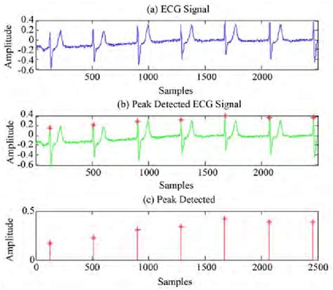 R Peaks Detection Using Ppt Download Scientific Diagram