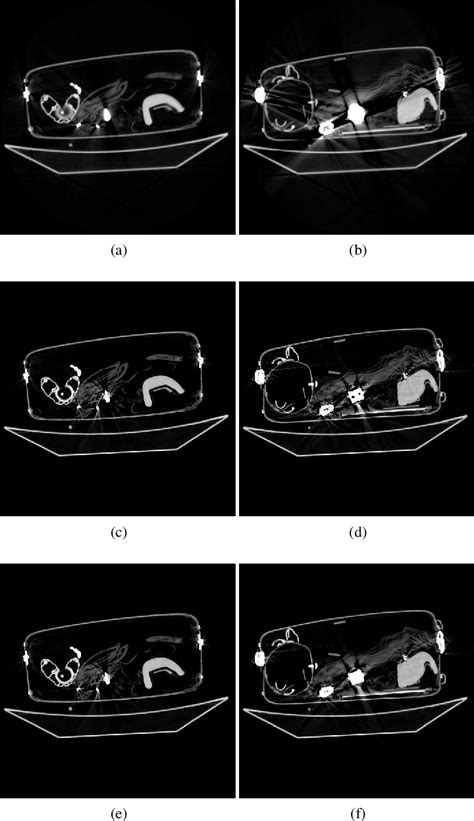 Figure 6 From A Model Based 3d Multi Slice Helical Ct Reconstruction