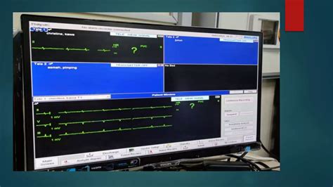 Telemetry Monitoring Pptx