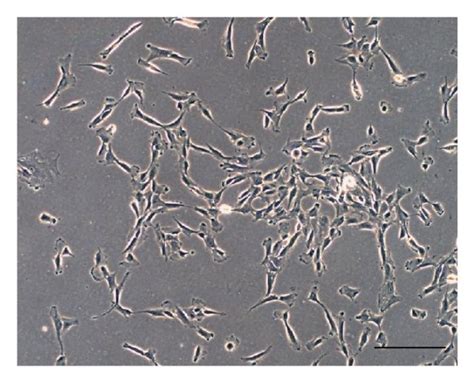 Small Round Cell Osteosarcoma Finite Cell Line Observation In Phase Download Scientific