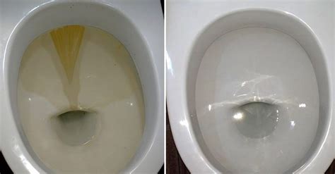 გულმოდგინე დიასახლისმა გაგვიზიარა საპირფარეშოს საწმენდი საშუალების