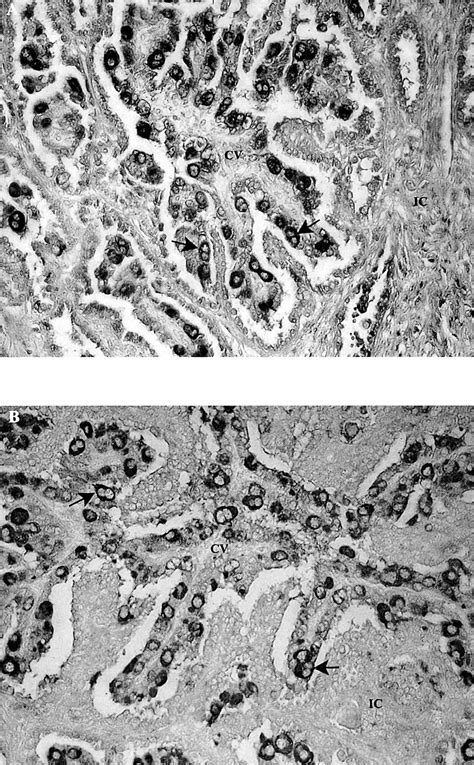 Representative Photograph Comparing Binucleate Cell Number In An Ai
