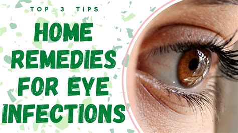 Home Remedies For Eye Infectionzip Eye Infections