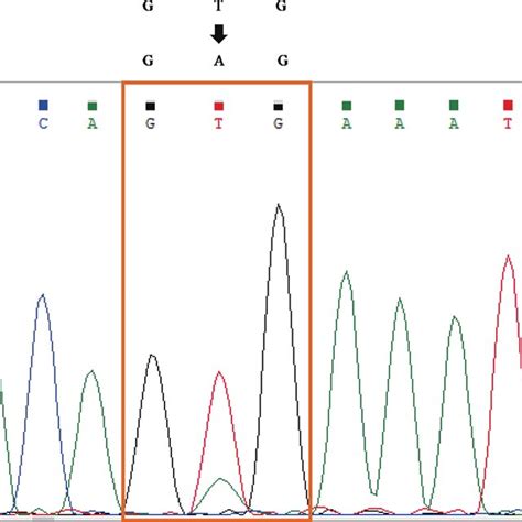 Braf V600e Mutation Analysis Direct Dna Sequencing Data From The Bone Download Scientific