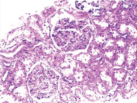An Example Of Color Normalization A Is The Source Image B Is The Download Scientific