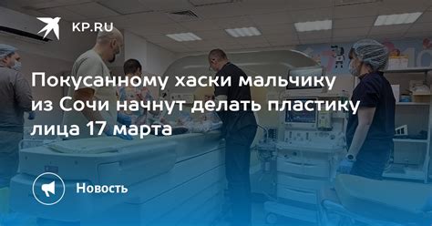 Покусанному хаски мальчику из Сочи начнут делать пластику лица 17 марта Kp Ru