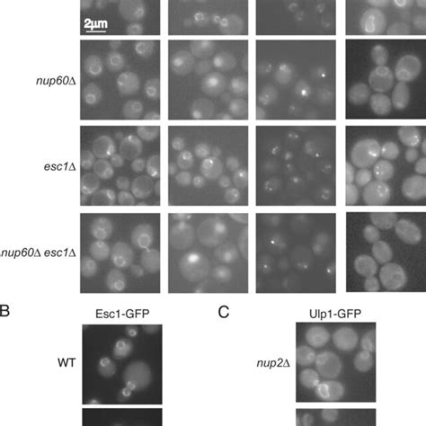 Nucleoporin And Npc Associated Protein Accumulation In Foci Of Esc1Δ