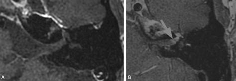 A Axial Contrast Enhanced T1 Weighted Spin Echo Sequence No Download Scientific Diagram