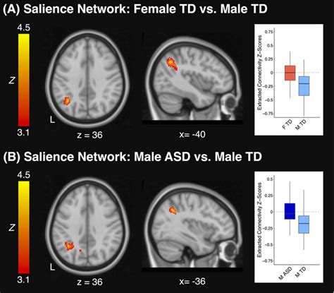 sex differences in functional connectivity of the salience default