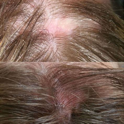 Scalp Cosmetic Enhancement Clinic