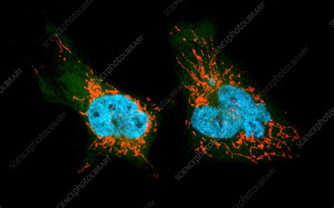 Cell Anatomy Light Micrograph Stock Image C056 9615 Science Photo Library