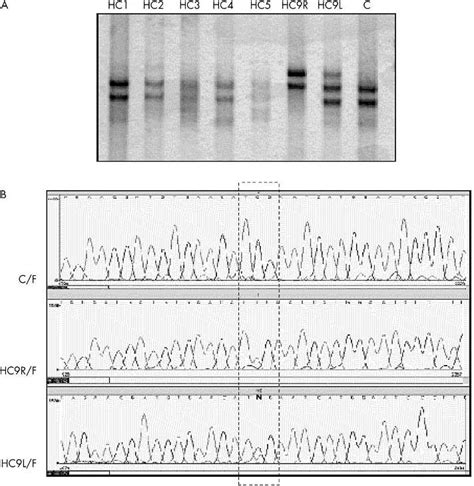 A Single Strand Conformational Polymorphism Sscp Analyses Of Exon