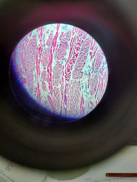 I Took Some Photos About My Last Celular Biology Practice Hope You