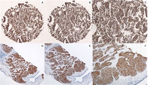 Uk Recommendations For Her2 Assessment In Breast Cancer An Update Journal Of Clinical Pathology