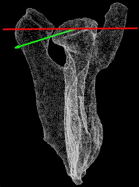 The Experimental Method Transverse View Showing Glenoid Version Download Scientific Diagram