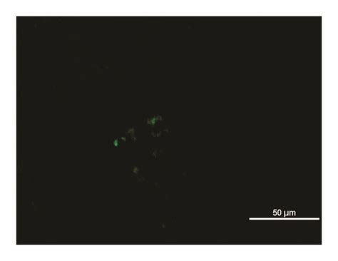 The Indirect Immunofluorescence Test On The Flask Propagated Download Scientific Diagram