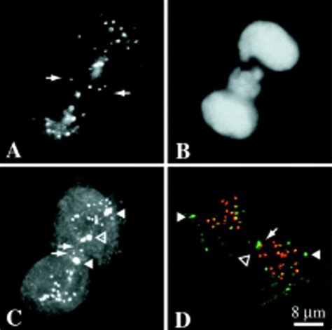 Lagging Chromosomes Have Undergone Sister Chromosome Separation A And Download Scientific