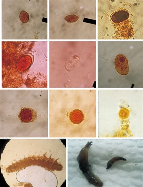 Whipworm Parasite Wellcome Sanger Institute Research Uncovers How