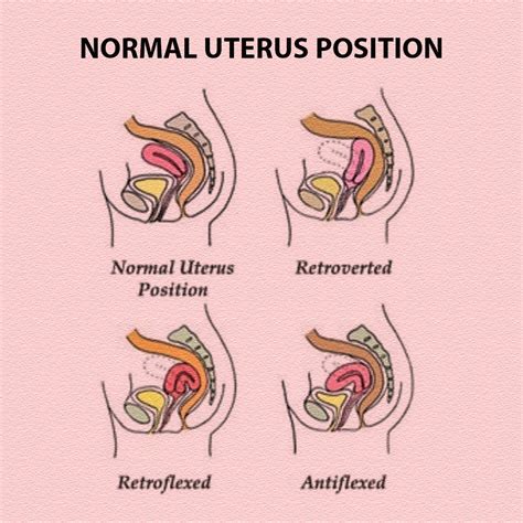 Pregnancy 👩‍⚕️ Normal Uterus Position Whats Typical 🧭 Anteverted