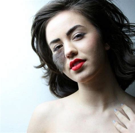 Unexplained Medical Anomalies