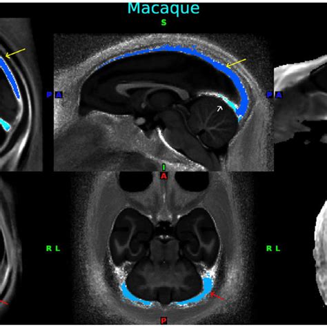 Cortical Thickness In Human Chimpanzee Macaque And Marmoset A
