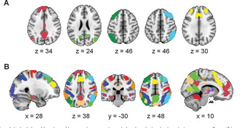Figure 1 From Decoding Subject Driven Cognitive States With Whole Brain