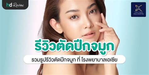 รีวิวตรวจคัดกรองมะเร็งปากมดลูก ด้วยเทคนิค Thinprep และหาเชื้อ Hpv Dna