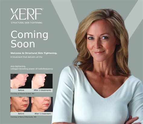 Xerf Skin Tightening In San Ramon Ca Lift And Firm Skin