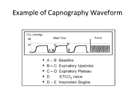 Capnography Current And Future Use By Ems Presented