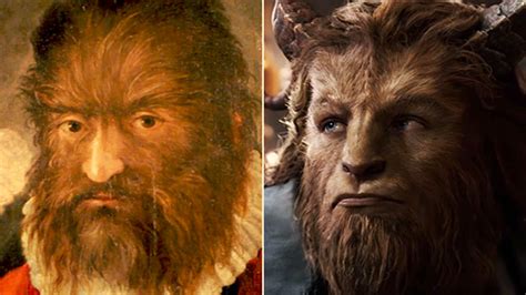 მზეთუნახავის და ურჩხულის შესახებ ზღაპარი გამოგონილი არაა ცხოველის მსგავსი მამაკაცის გასაოცარი