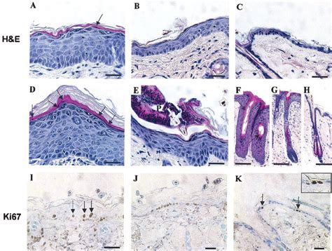 Expression Of Hdsg3 Results In Epidermal Hyperproliferation